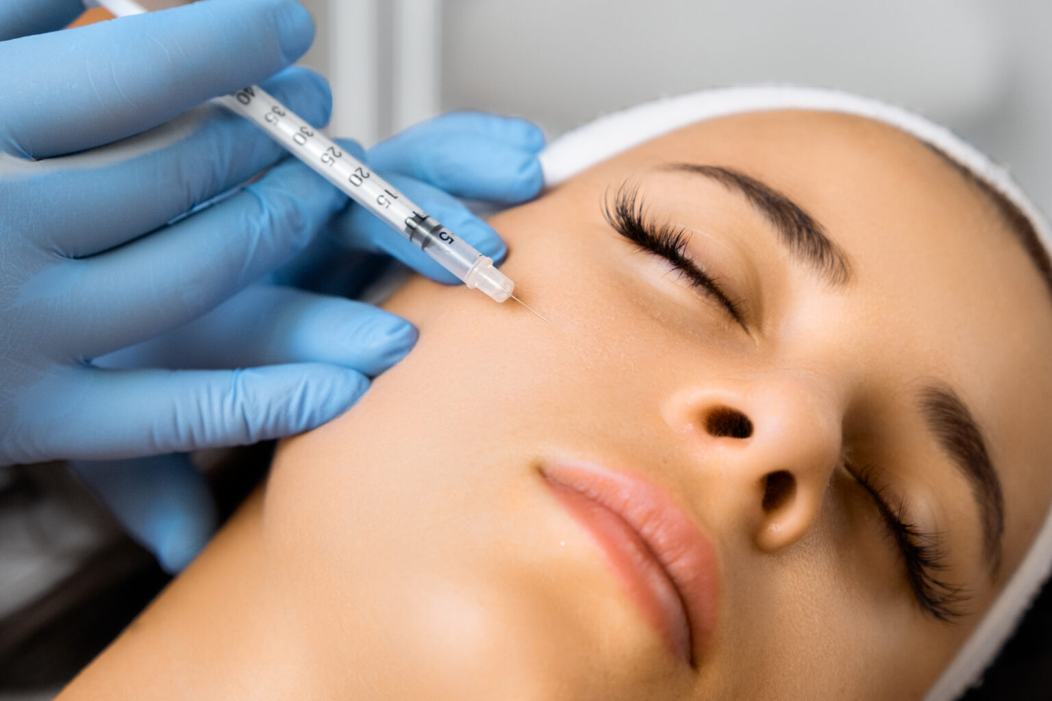 Restylane Contour- San Luis Obispo, CA | Revive MD Medical Group
